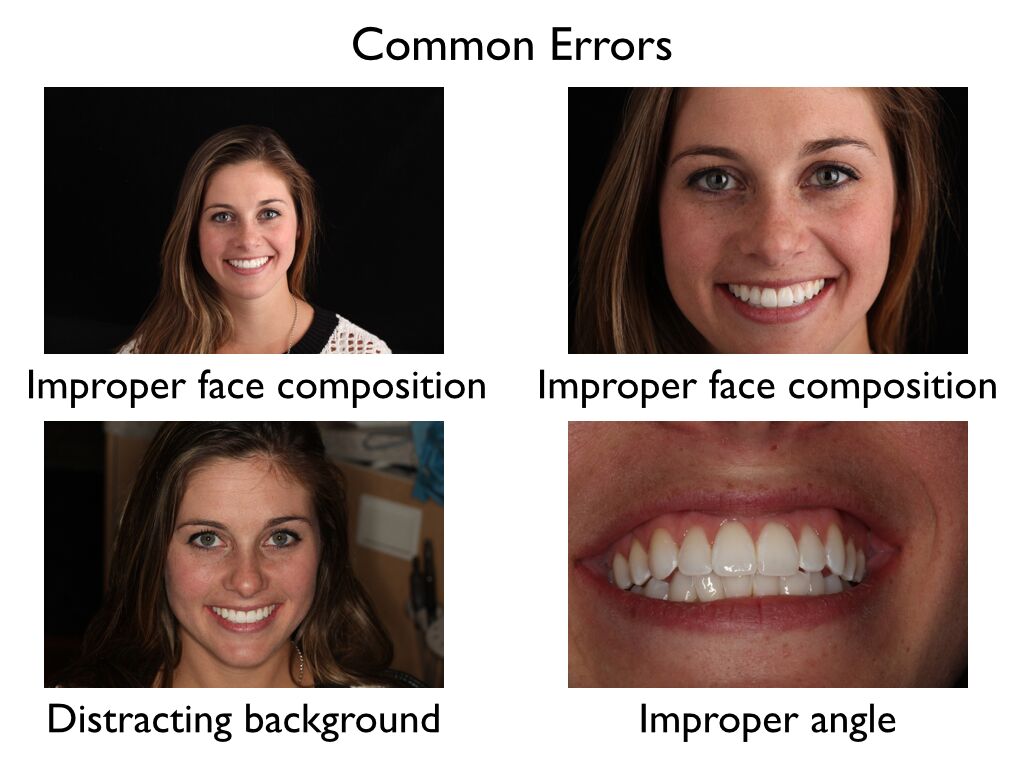 How to Get the Shot: 2 Essential Dental Photography Tips